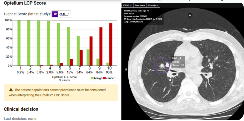 Optellum | The lung health company