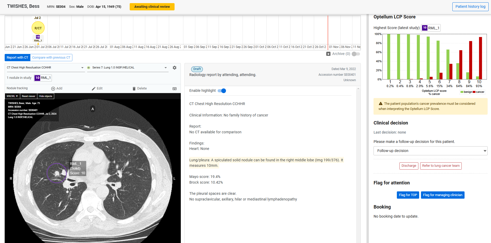 Optellum | Media kit